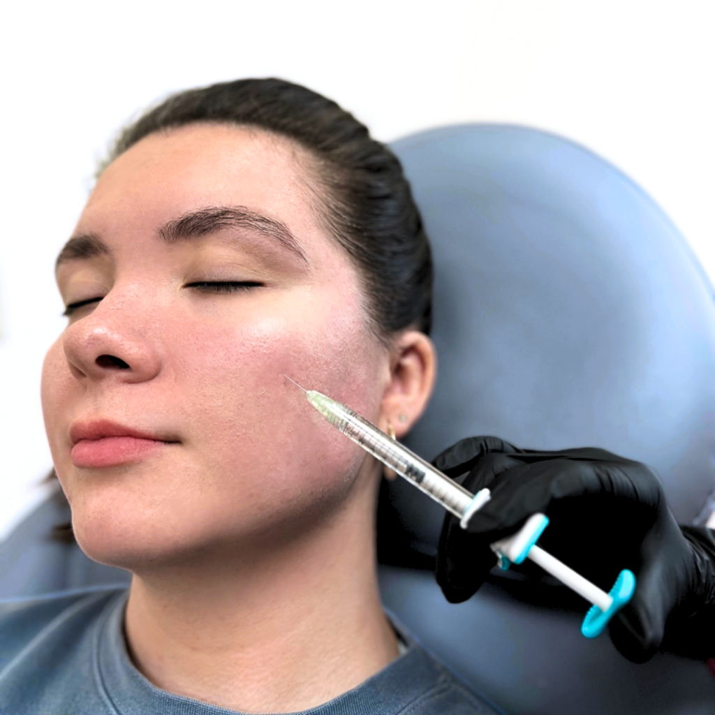 SKINVIVE | The first and only injectable for hydration now at Catalyst